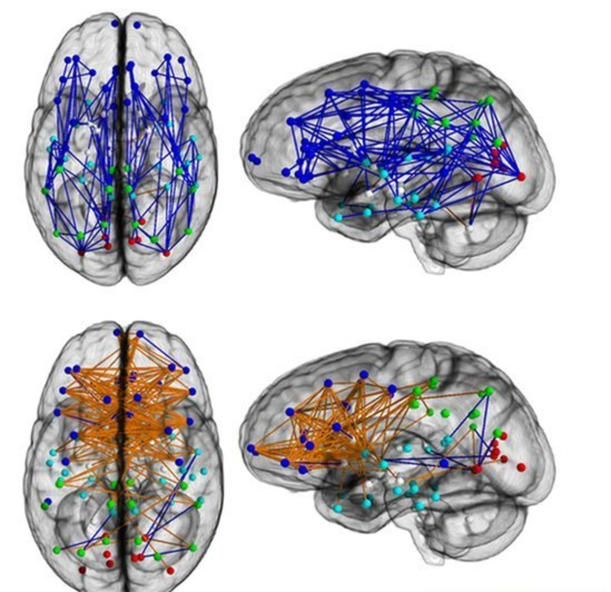 Man vs vrouw: zo anders werken onze hersenen | De Morgen