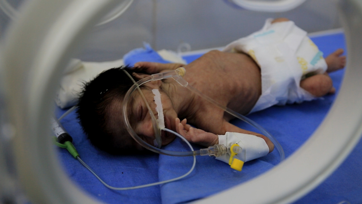 ‘Ik ben bang dat onze nieuwe baby ook misvormd is’: de onzichtbare ...