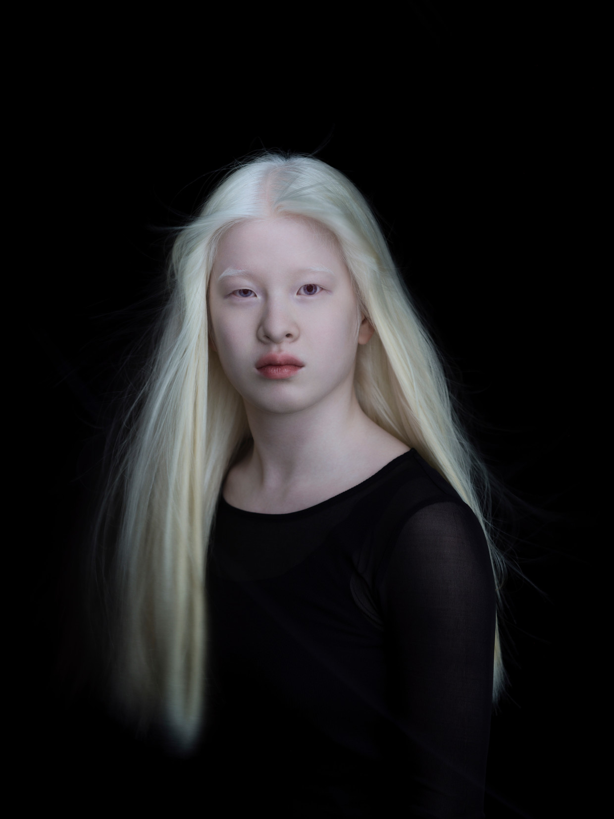 Vondeling met albinisme wordt model en Unesco-ambassadeur: ‘Ik wil ...