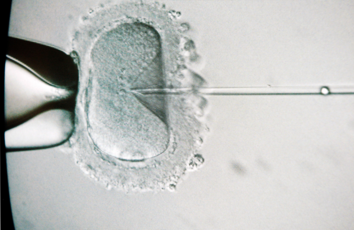 De gynaecoloog die besloot zelf zaad te doneren: ‘Ik moest toch wat doen’