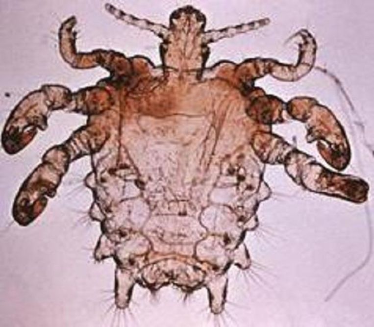 Nederlands museum wil verzameling schaamluizen aanleggen | De Morgen