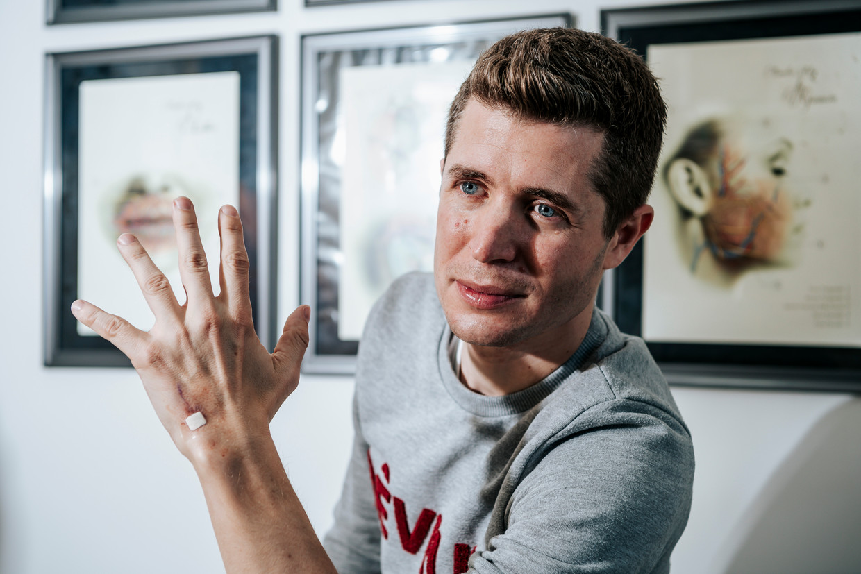 Techjournalist Kenneth Dée liet een betaalchip inplanten: ‘Voor kleine ...