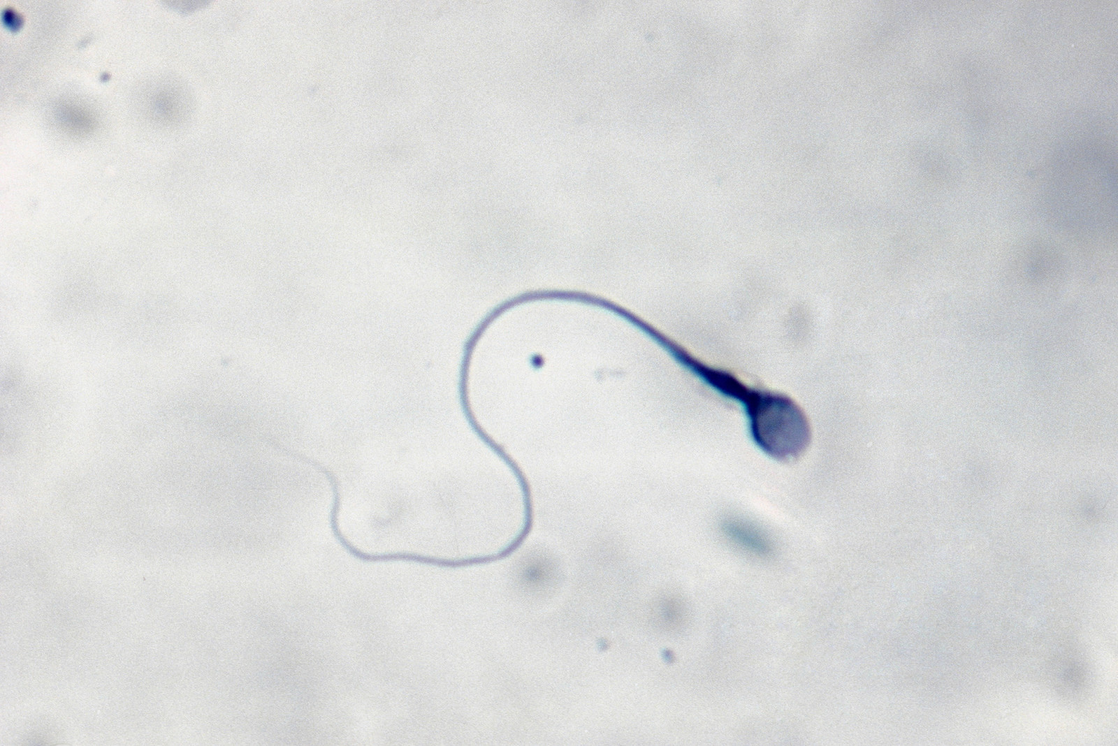 Gaat het echt zó slecht met de spermakwaliteit? ‘Paniek is niet nodig’